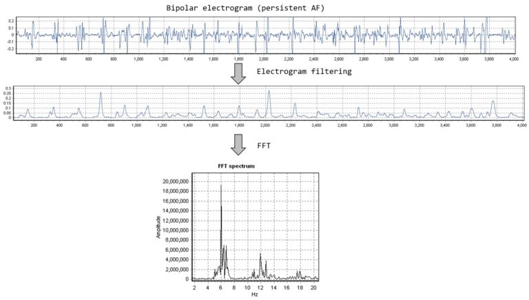Dominant Frequency - Pawel Kuklik, PhD