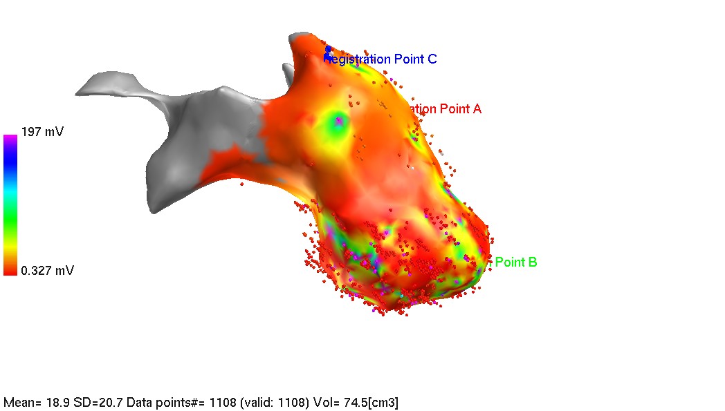 Spatial registration of 3D map and stack of slices images - Pawel ...