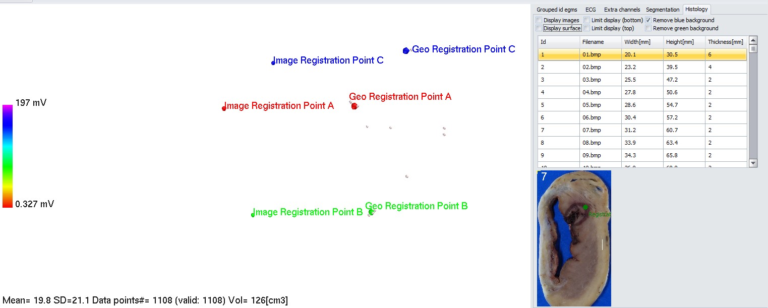 Spatial registration of 3D map and stack of slices images - Pawel ...