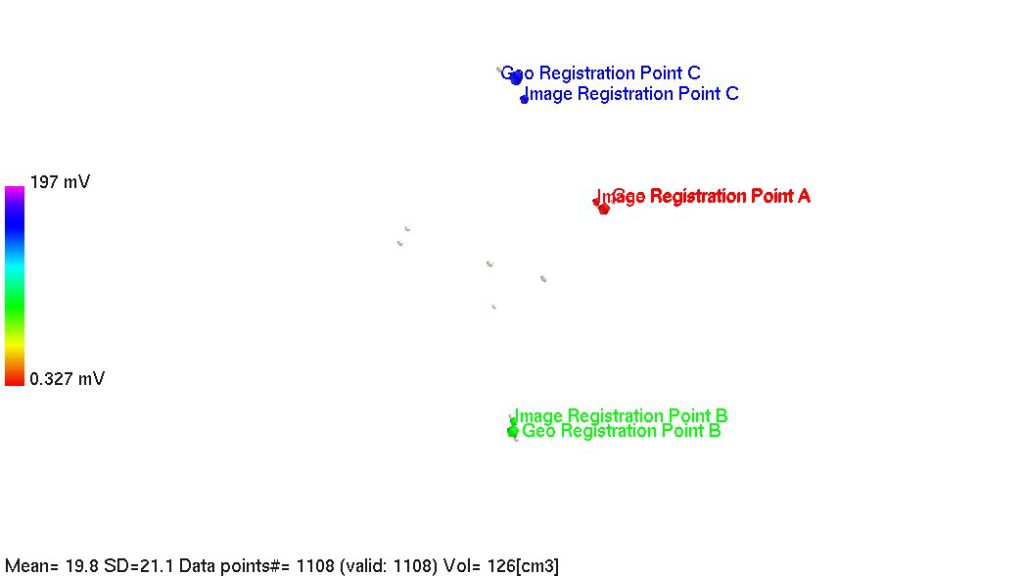 Spatial registration of 3D map and stack of slices images - Pawel ...