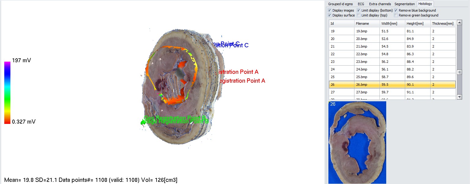 Spatial registration of 3D map and stack of slices images - Pawel ...