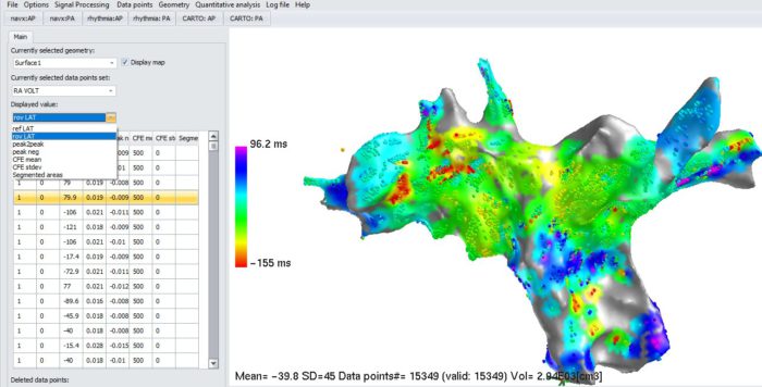 Calculating Wavefront Propagation Velocity map - Pawel Kuklik, PhD